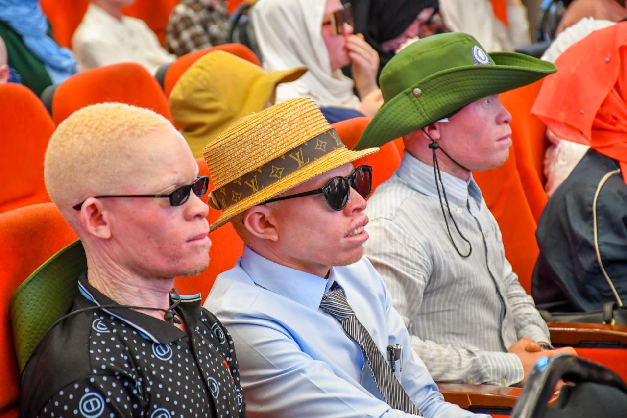 Wenye ualbino watoa mapendekezo kubadilishwa kwa jina la wizara | Nipashe